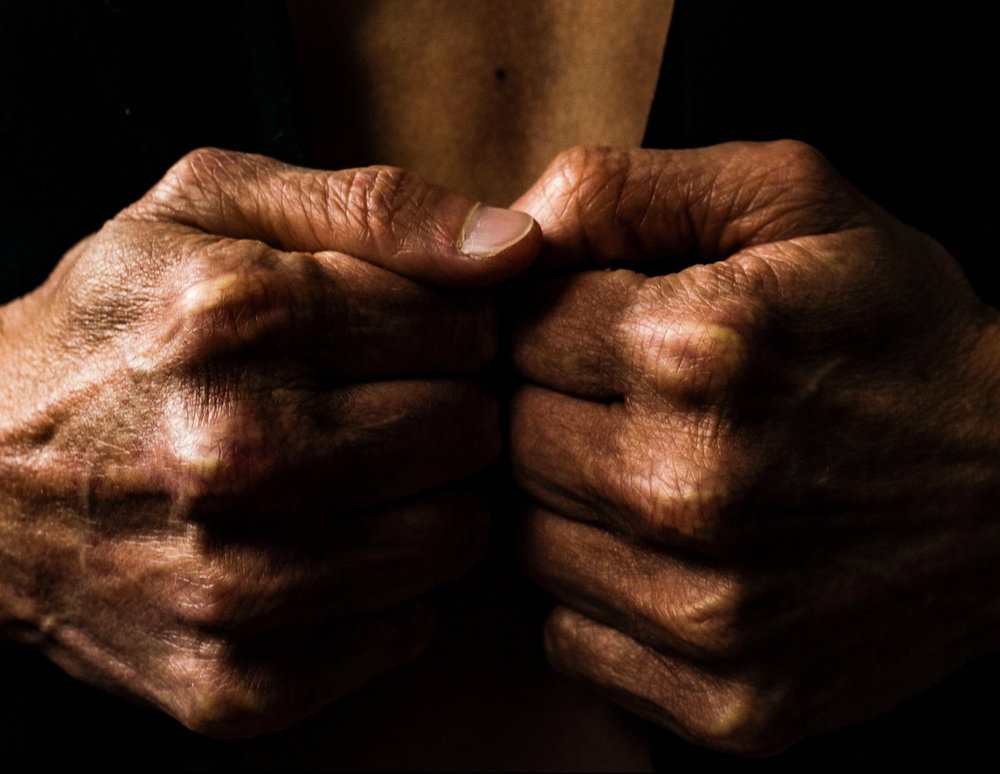 The Diagnosis – Staying Connected